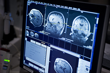 Tests Before Surgery for Seizures | Epilepsy Foundation